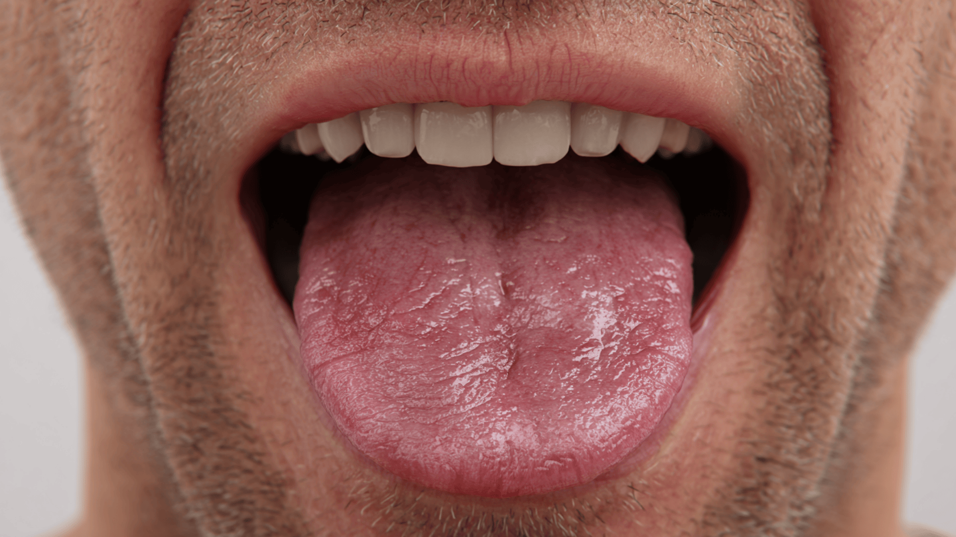 Tongue Signs of Sleep Apnea: What to Look For - Easy Rest